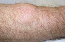 Minor Skin-Surgery - Clinical Options